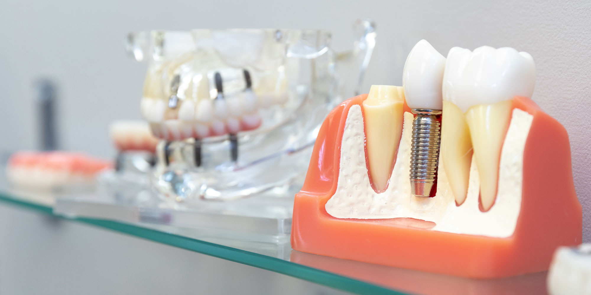 Teeth in a Day | Cook Periodontics | Wilmington, NC