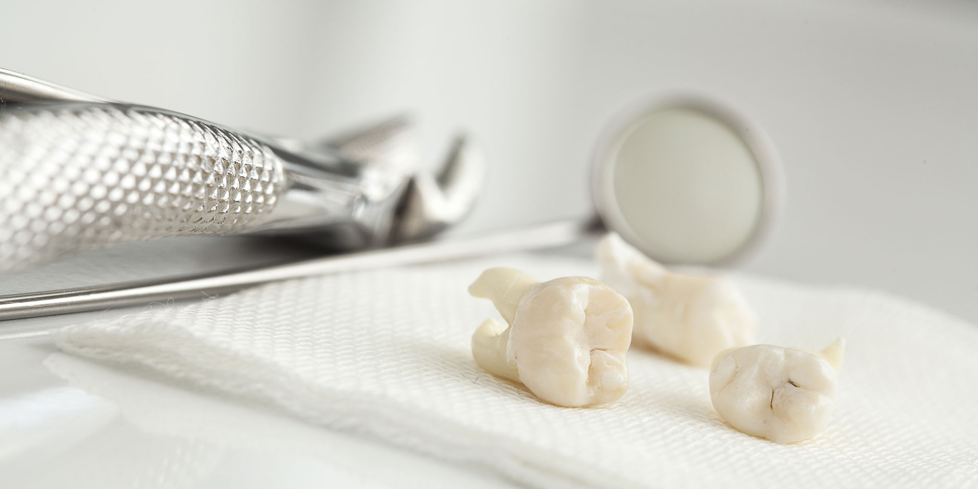 Tooth Extraction | Dental Extractions | Wilmington, NC