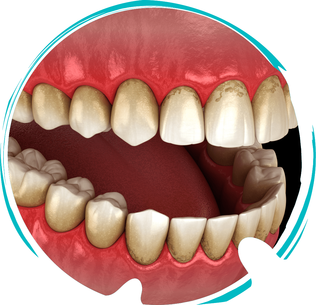 Heart Disease | Cook Periodontics Wilmington, NC